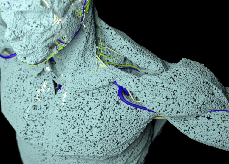 Trigeminal Neuralgia Specialists - Scrambler Nerve Clinics Of Florida